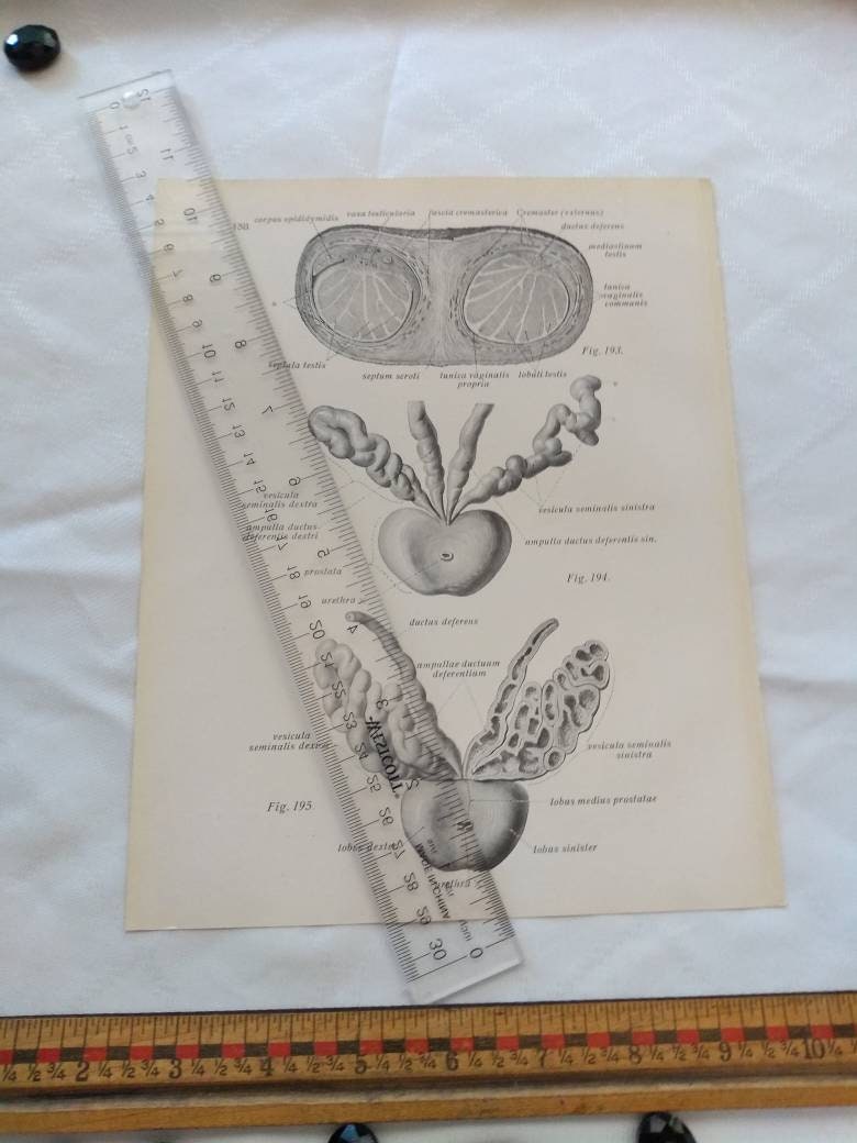 Testicules Testies Prostate Diagram Dissection Anatomy Drawing Vintage ...