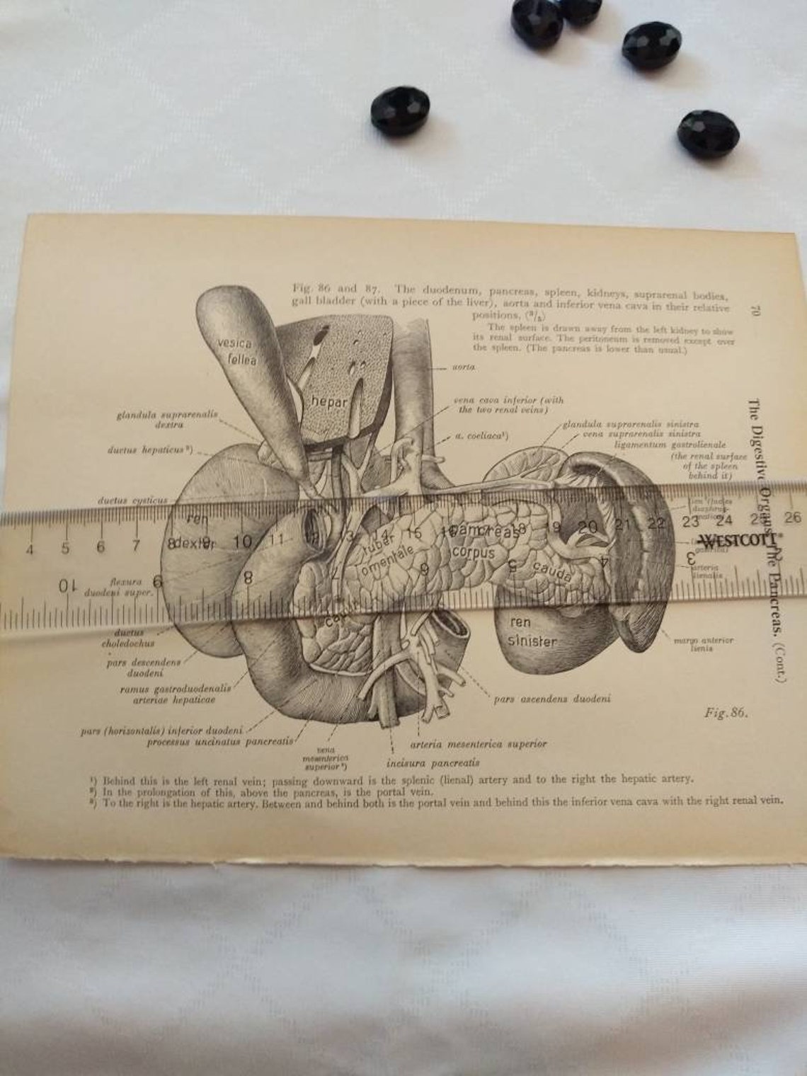 Pancreas Digestive Organs Diagram Dissection Anatomy Drawing - Etsy