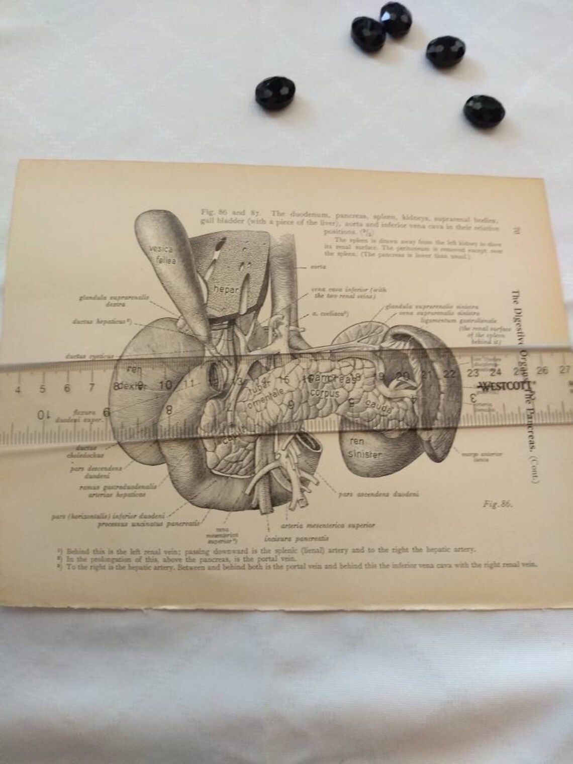Pancreas Digestive Organs Diagram Dissection Anatomy Drawing - Etsy