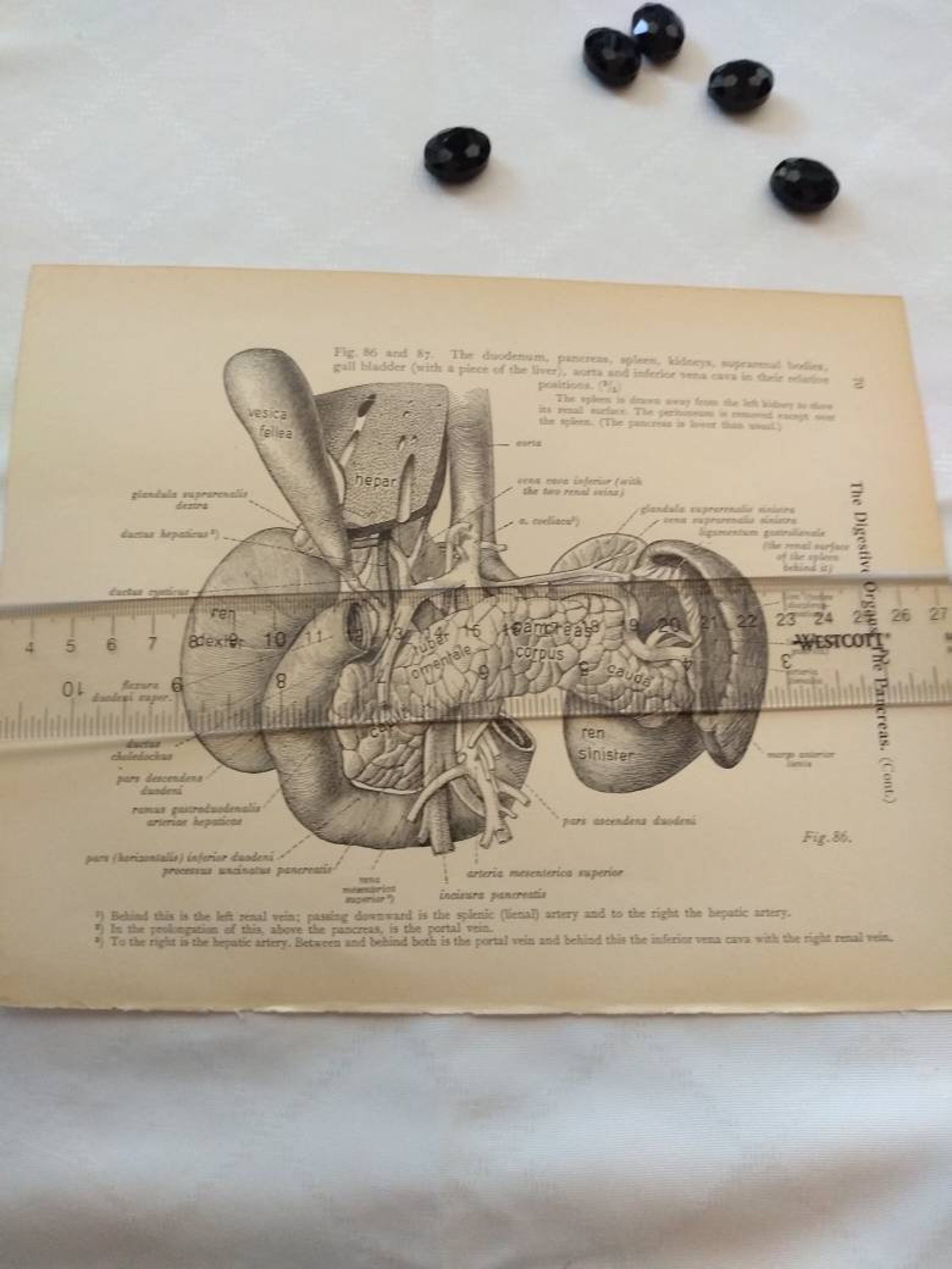 Pancreas Digestive Organs Diagram Dissection Anatomy Drawing Vintage ...