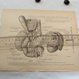 Pancreas Digestive Organs Diagram Dissection Anatomy Drawing Vintage ...