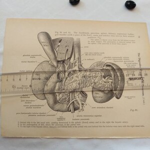Pancreas Digestive Organs Diagram Dissection Anatomy Drawing Vintage ...