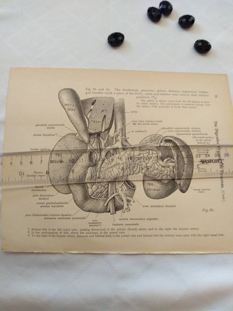 Pancreas Digestive Organs Diagram Dissection Anatomy Drawing - Etsy