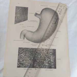 Oesophagus Aorta Stomac Diagram Dissection Anatomy Drawing Vintage ...