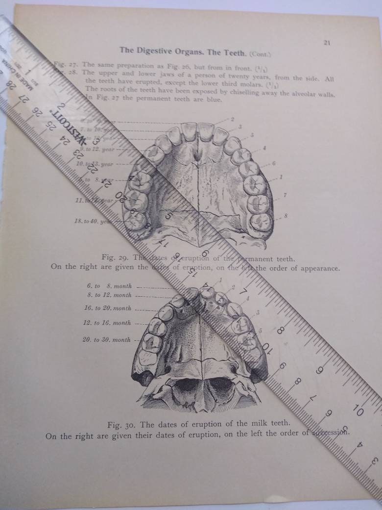 Teeth Cross Section Diagram Dissection Anatomy Drawing Vintage - Etsy