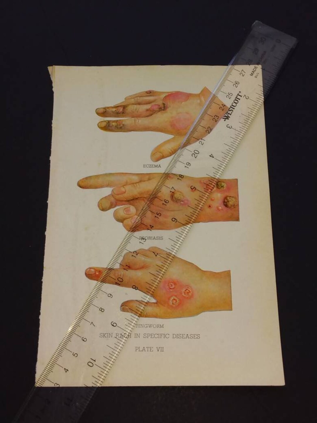 Skin Rash in Specific Disease Print Infection Medical Book Library ...