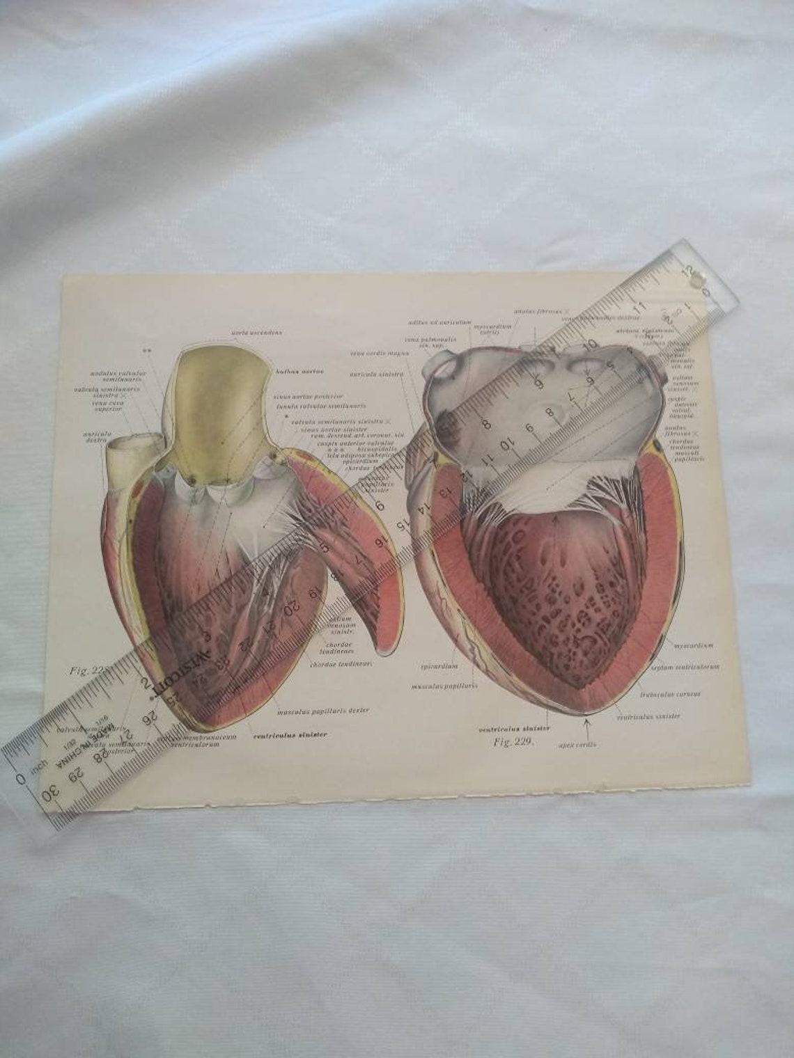Diagrama del corazón Disección Anatomía Dibujo Vintage Medical - Etsy ...