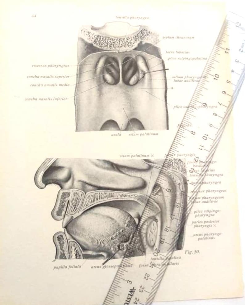 Troat Trachea Cross Diagram Dissection Anatomy Drawing Vintage Medical ...