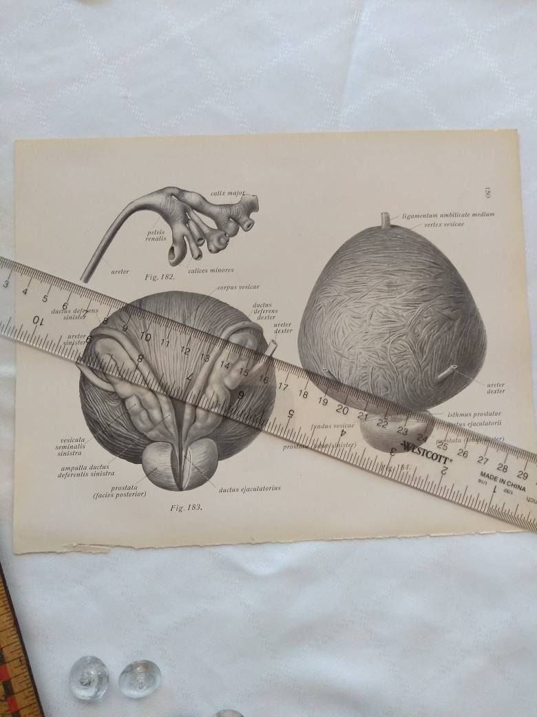 Bladder Urinary Track Prostate Diagram Dissection Anatomy Drawing ...