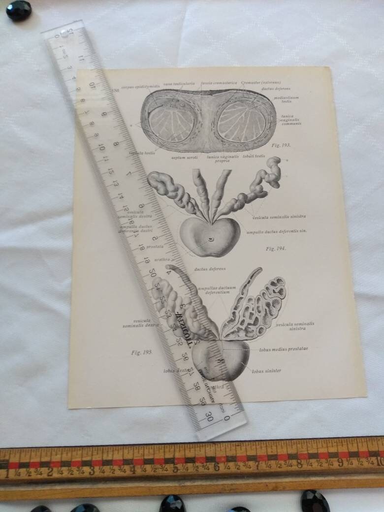 Testicules Testies Prostate Diagram Dissection Anatomy Drawing | Etsy