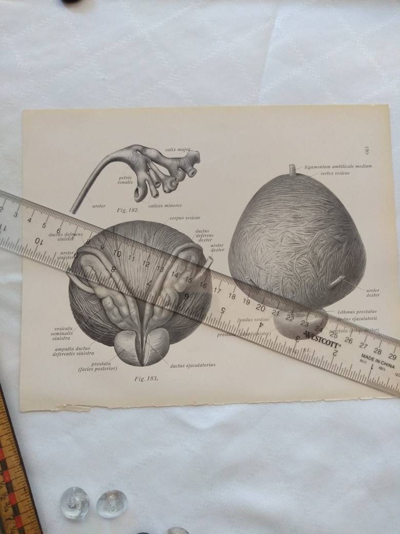 Bladder Urinary Track Prostate Diagram Dissection Anatomy - Etsy