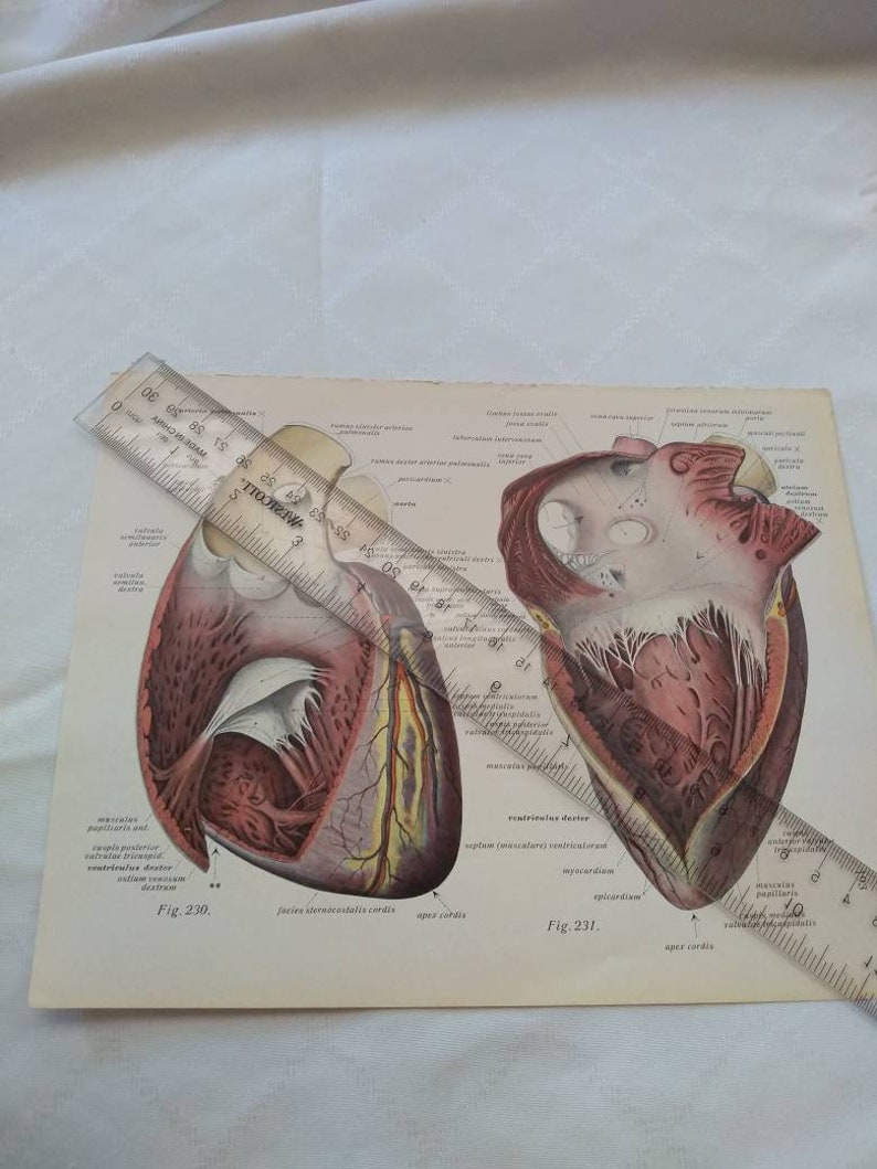 Heart Diagram Dissection Anatomy Drawing Vintage Medical | Etsy