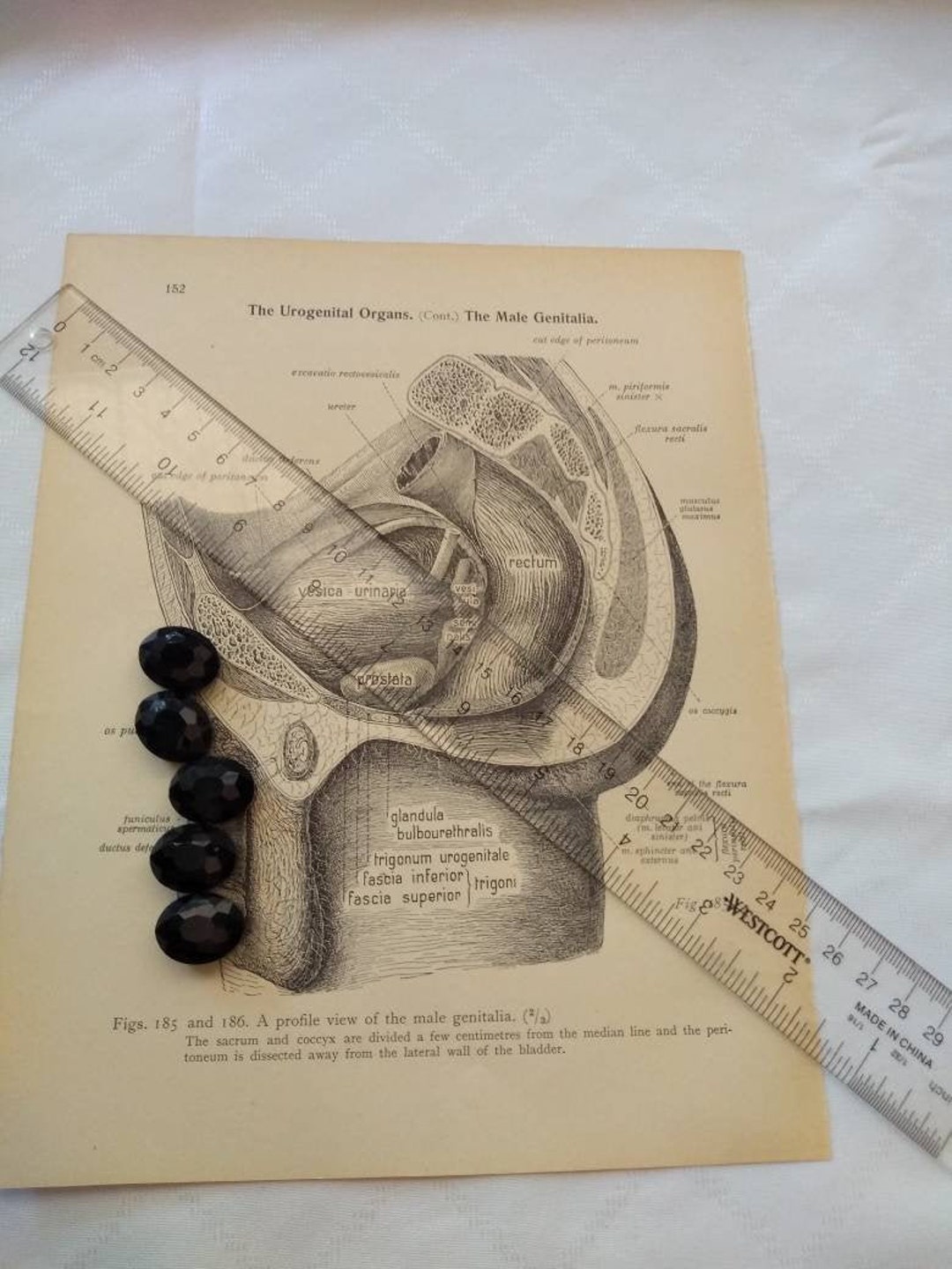 Nudity! Male Genitalia Cross Diagram Dissection Anatomy Drawing Vintage ...