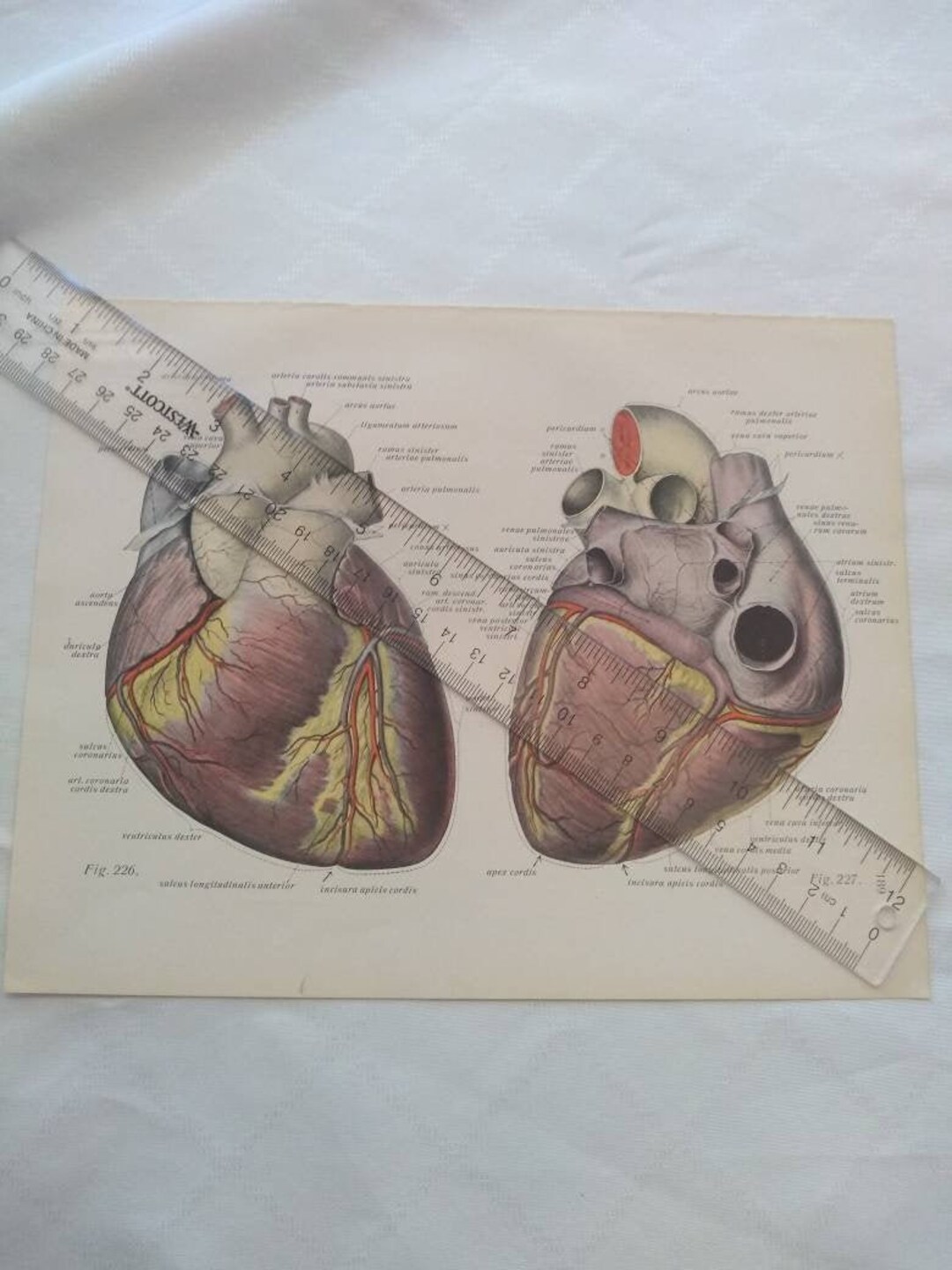 Heart Diagram Dissection Anatomy Drawing Vintage Medical Textbook Print ...