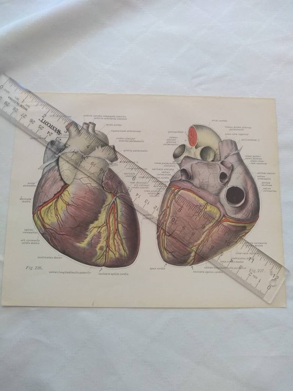 Diagrama del corazón Disección Anatomía Dibujo Vintage Medical - Etsy ...