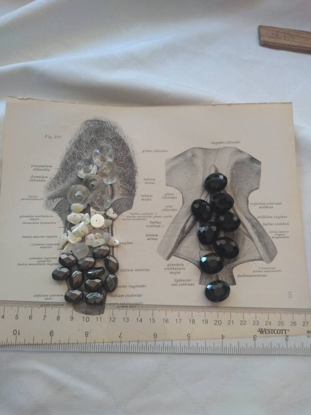 Nudity Female Genitalia Uterus Vagina Front Diagram Dissection Anatomy Drawing Vintage Medical ...