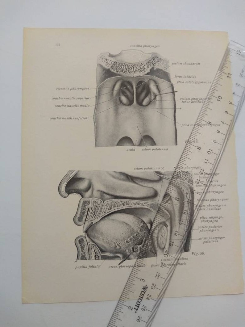 Troat Trachea Cross Diagram Dissection Anatomy Drawing Vintage - Etsy