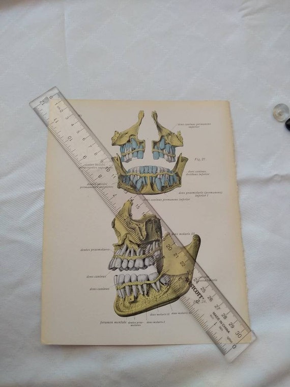 Skull Teeth Diagram Dissection Anatomy Drawing Vintage Medical - Etsy