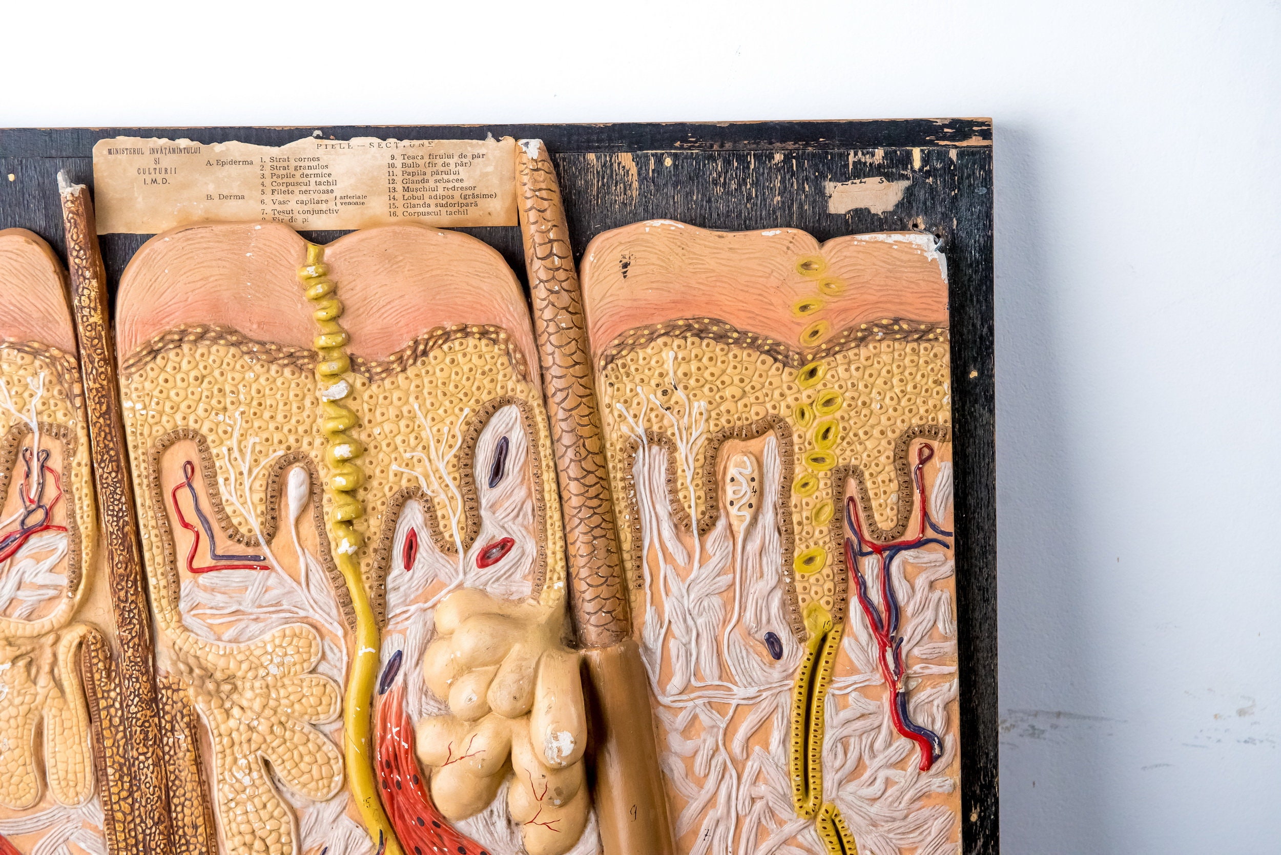 Antique Anatomical/ Skin Anatomy/ Retro Educational Wall Art/ Medical ...