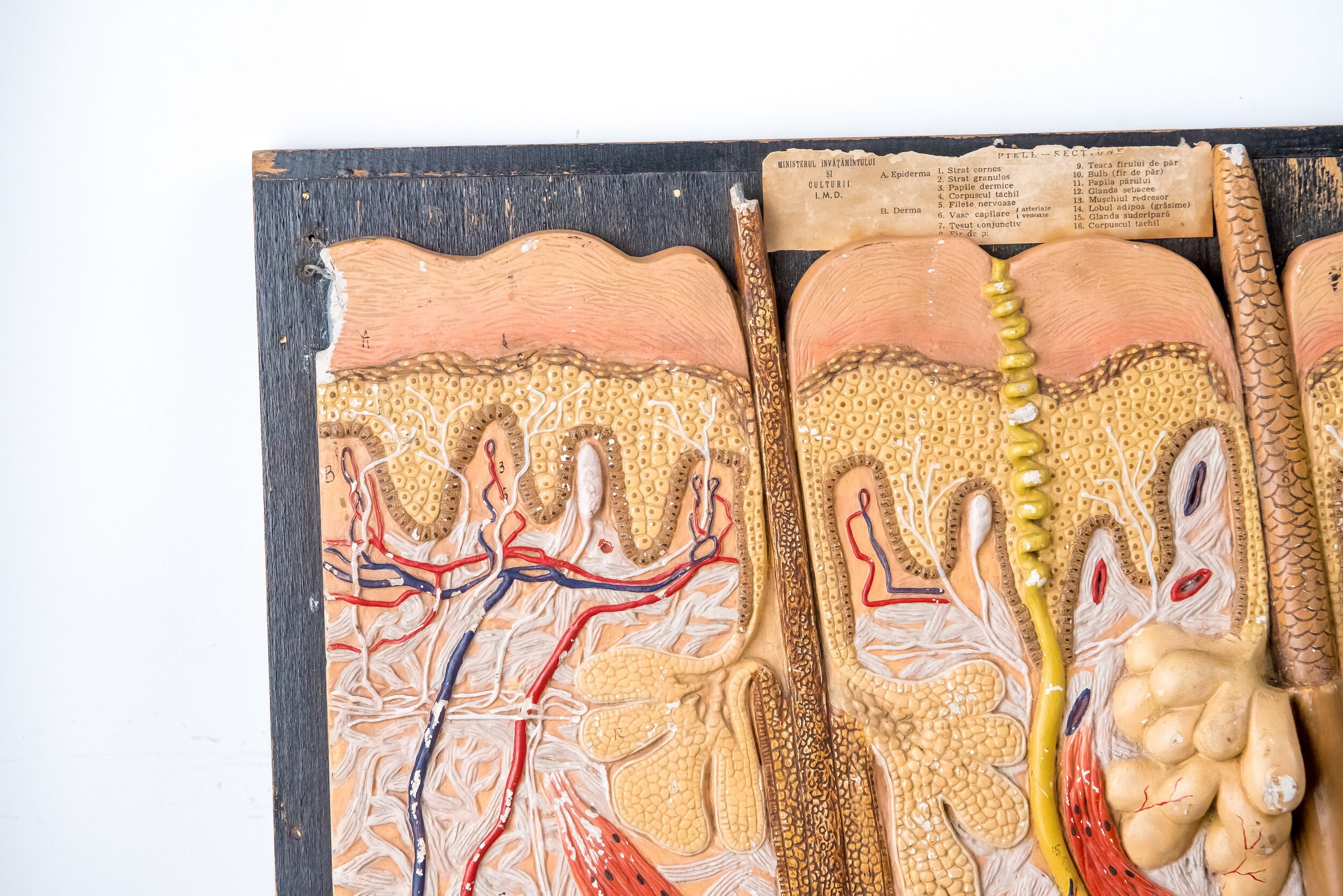 Antique Anatomical/ Skin Anatomy/ Retro Educational Wall Art/ Medical ...