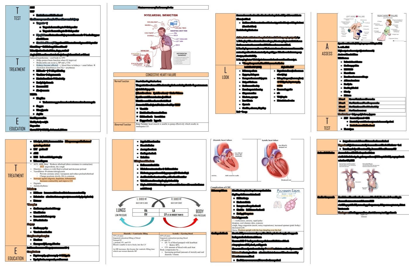 Cardiac Nursing Notes Bundle - 21 PAGES - Etsy