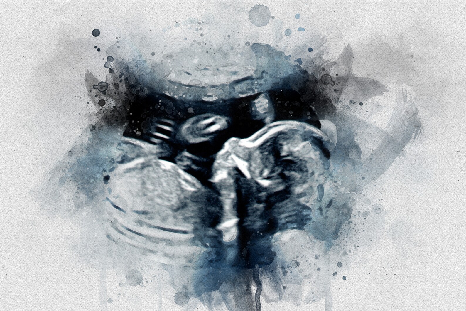 Custom Gender Reveal Art Baby Shower Gift Baby Ultrasound Art - Etsy