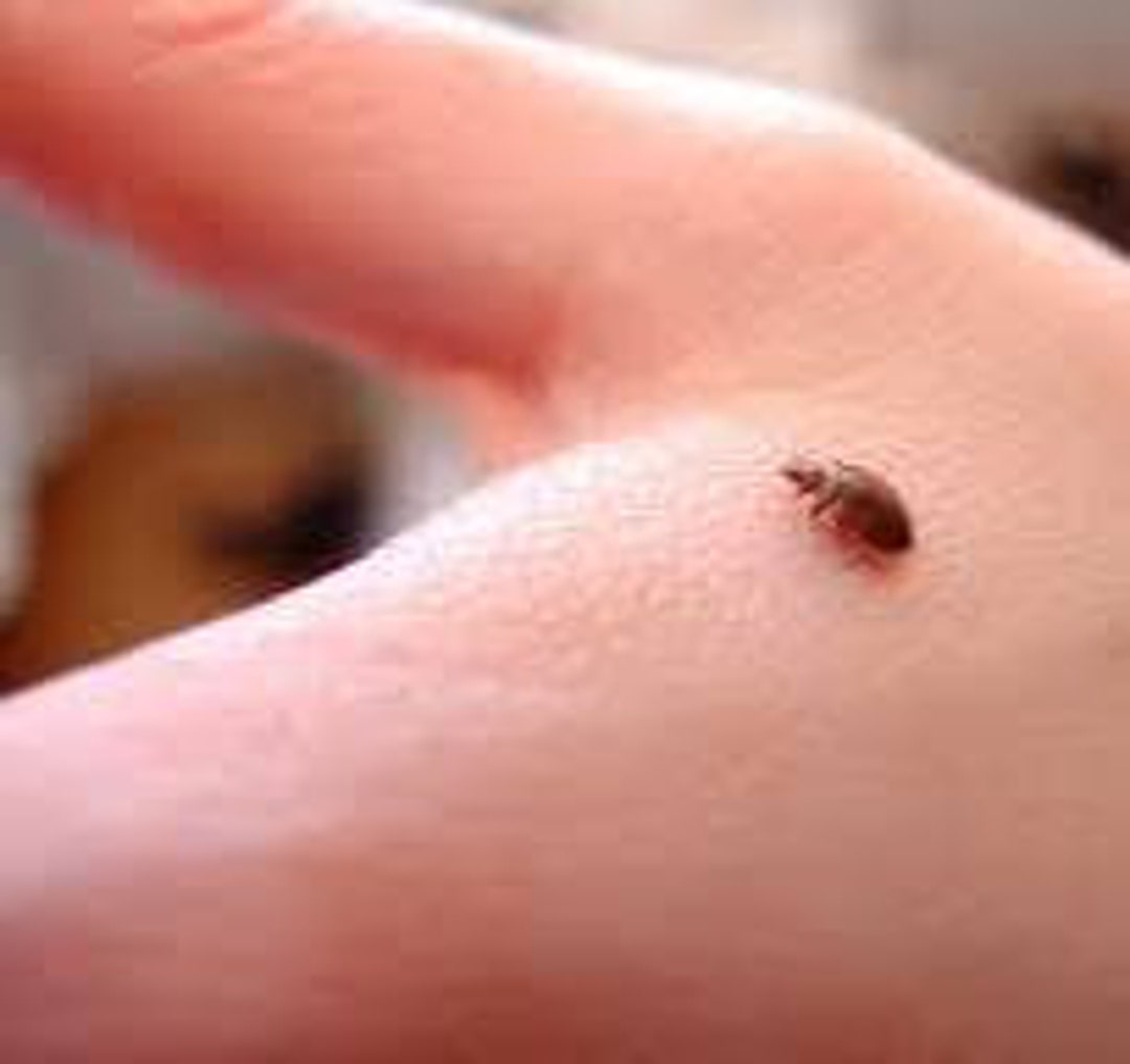 Home-made Bed Bug Solution for Life That Works 100% and Multiple Uses - Etsy