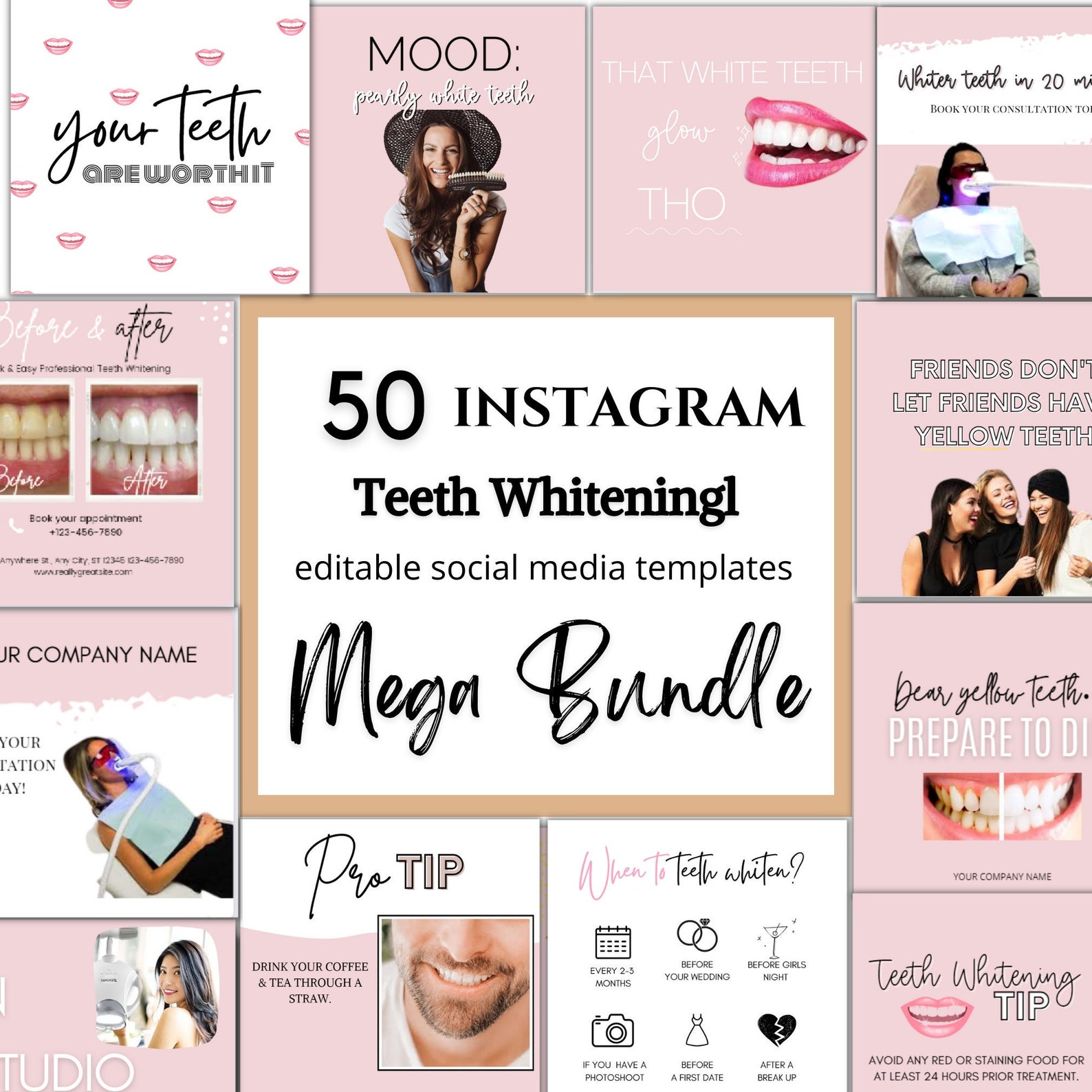 50 Teeth Whitening Instagram Post Templates, Editable Teeth Whitening ...