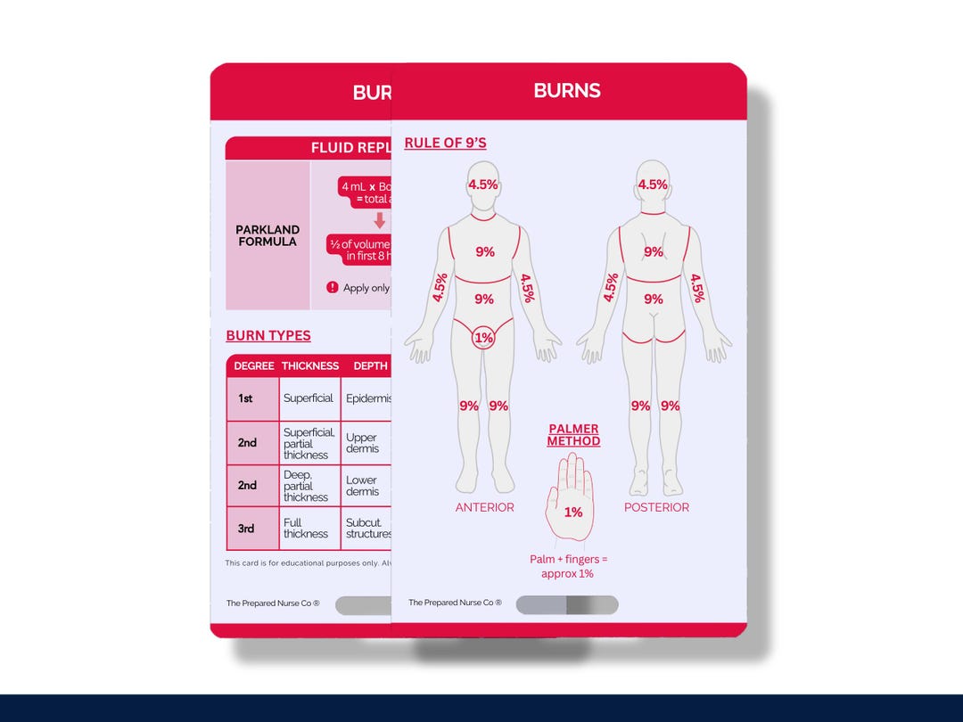 Burns, Nurse Reference Card, Rule of Nines Burns, Rule of 9s Badge Card ...