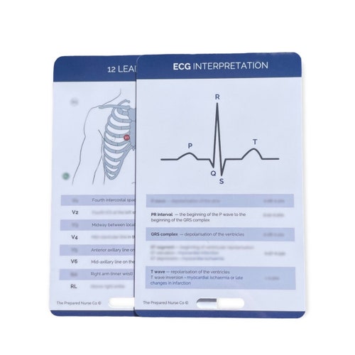 ECG Healthcare Nursing Medical Pocket Card - Etsy Australia