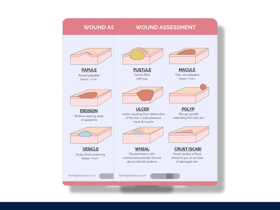 Wound Types, Nursing Reference Card, Wound Care Badge Buddy, Wound ...