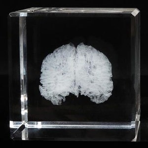 Human Brain white Matter Crystal Sculpture - Etsy