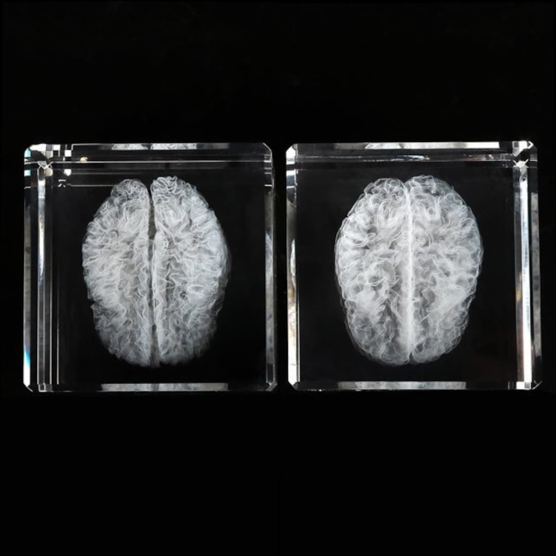 Human Brain - Set of Pial and White Matter Surface Sculptures - Etsy