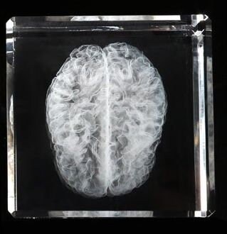 Human Brain Pial Surface (grey Matter) Crystal Paperweight - Etsy