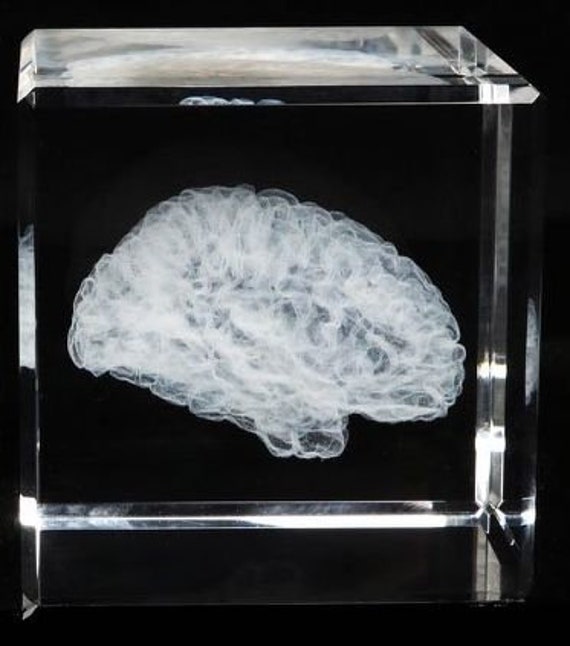 Human Brain Pial Surface Grey Matter Crystal Paperweight | Etsy