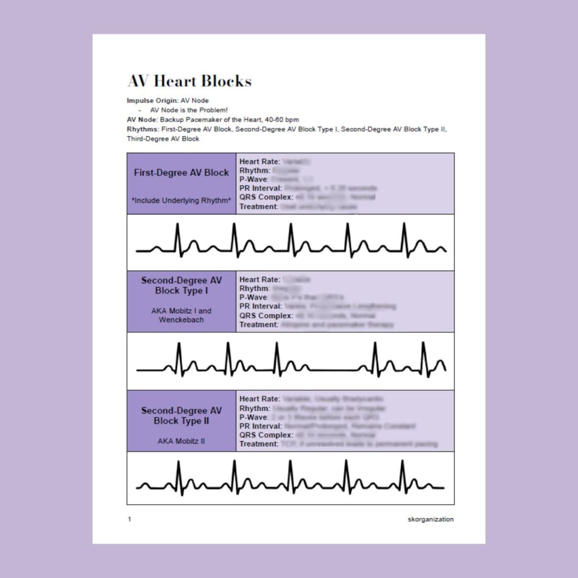 AV Heart Blocks | ECG Basics | ECG Interpretation | Cheat Sheet ...