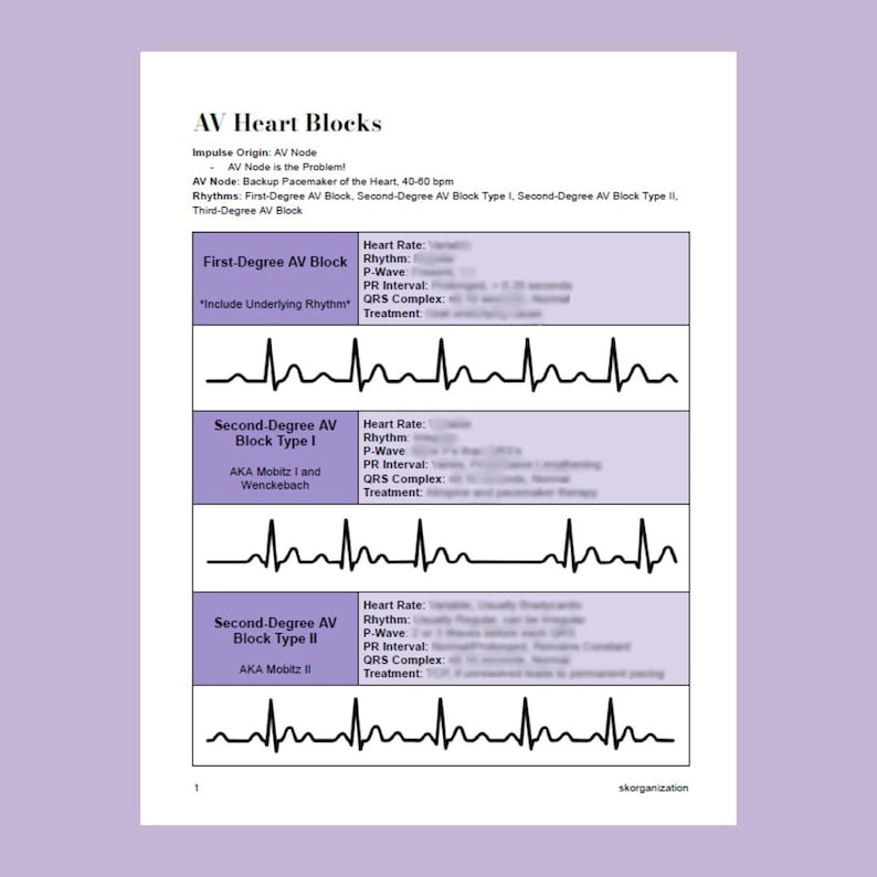 AV Heart Blocks | ECG Basics | ECG Interpretation | Cheat Sheet ...