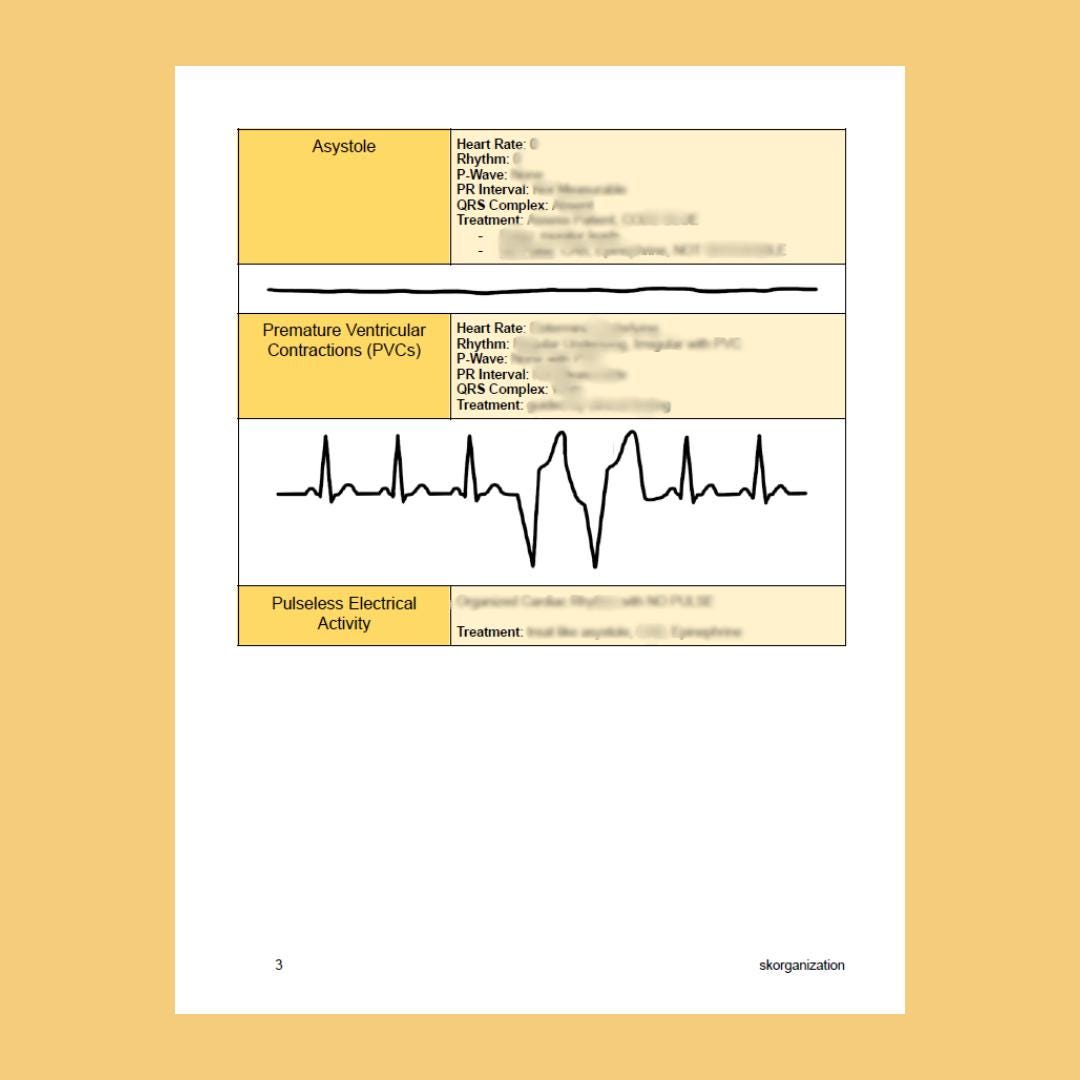 Ventricular Rhythms | ECG Basics | ECG Interpretation | Cheat Sheet ...