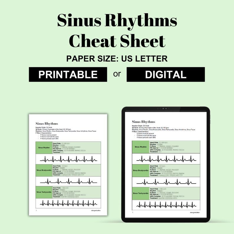 Sinus Rhythms | ECG Basics | ECG Interpretation | Cheat Sheet | Nursing ...