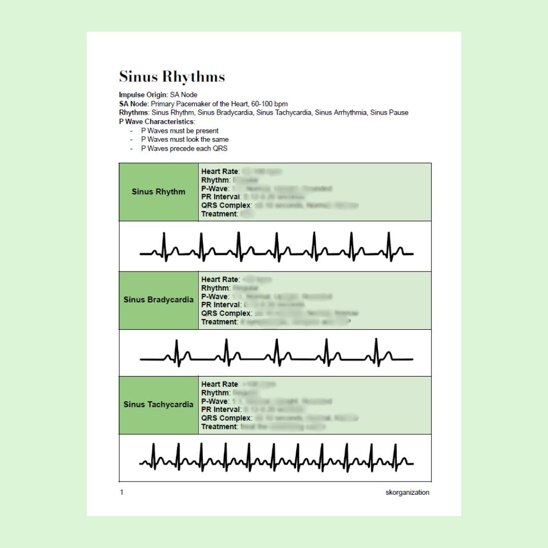 Sinus Rhythms | ECG Basics | ECG Interpretation | Cheat Sheet | Nursing ...