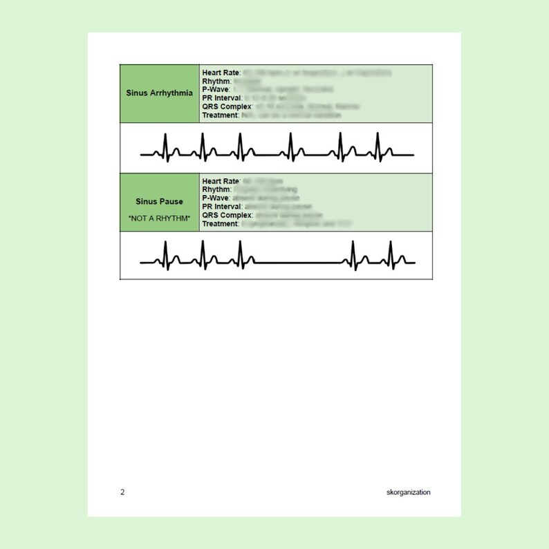 Sinus Rhythms | ECG Basics | ECG Interpretation | Cheat Sheet | Nursing ...