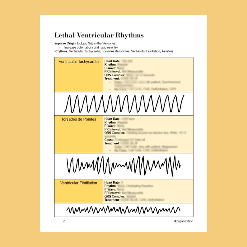 Ventricular Rhythms | ECG Basics | ECG Interpretation | Cheat Sheet ...