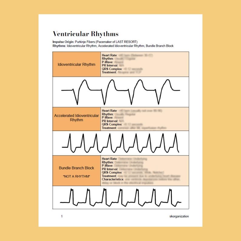 Ventricular Rhythms | ECG Basics | ECG Interpretation | Cheat Sheet ...