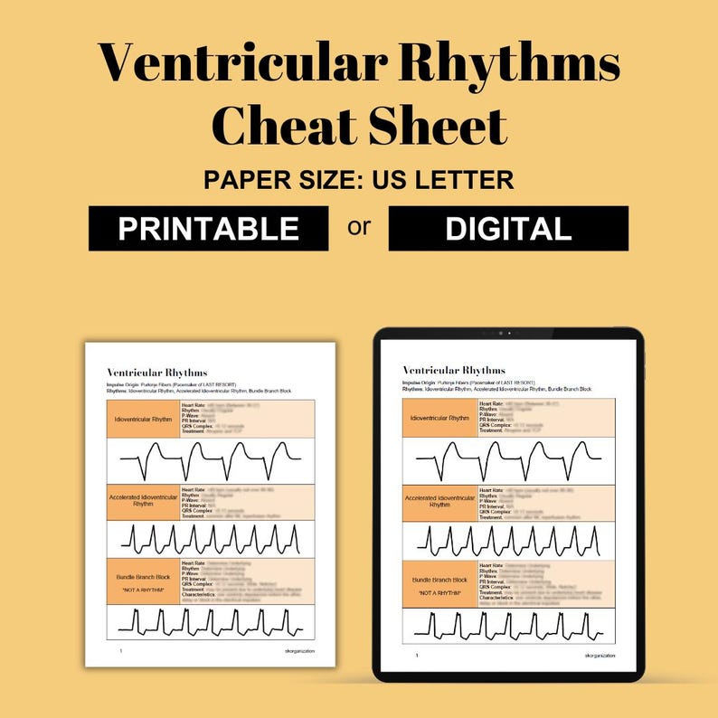 Ventricular Rhythms | ECG Basics | ECG Interpretation | Cheat Sheet ...