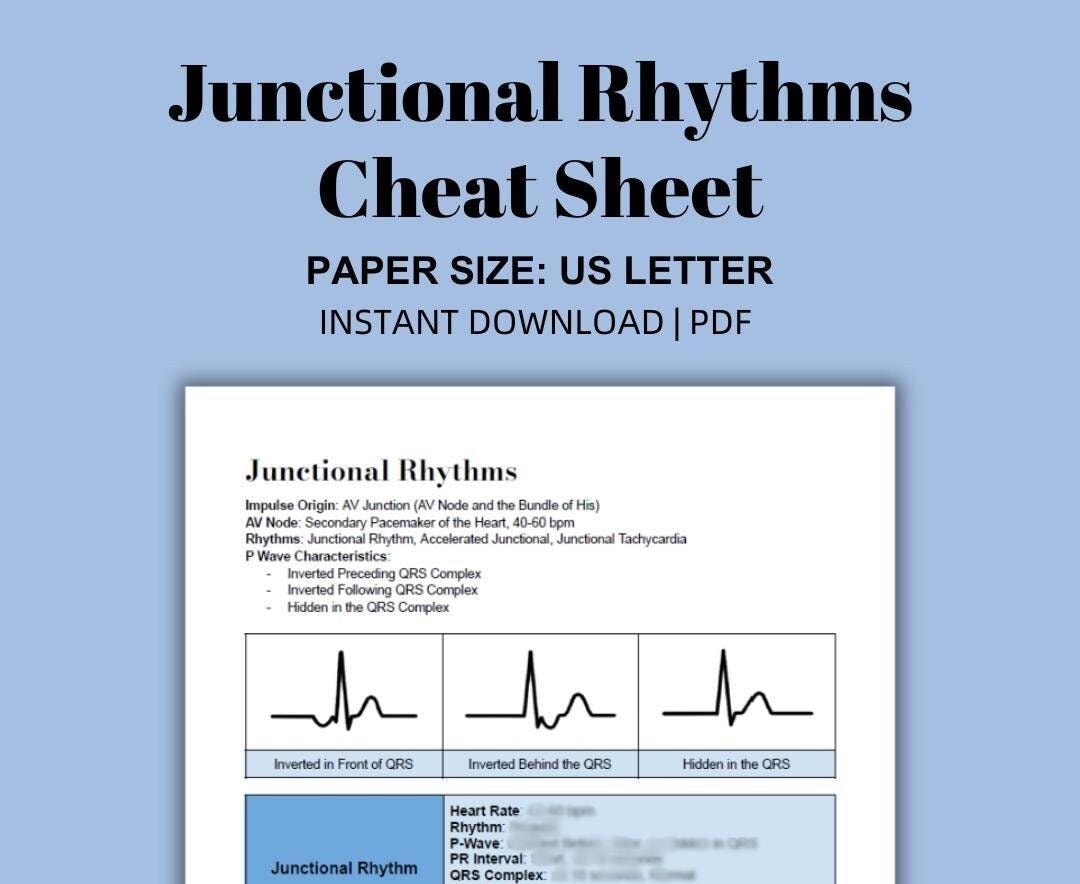Junctional Rhythms | ECG Basics | ECG Interpretation | Cheat Sheet | Nursing | NCLEX | Printable ...