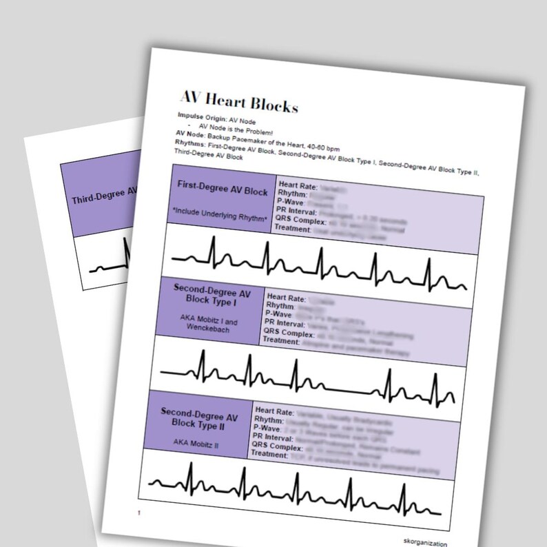 ECG Basics and Interpretation Bundle | Cheat Sheet | Nursing | NCLEX ...