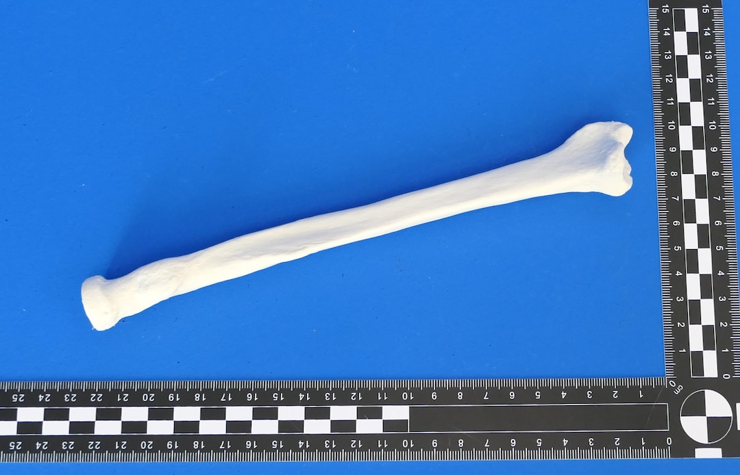 Radius Bone Human, Replica / Copy of a Radius, Anatomy Bone for ...