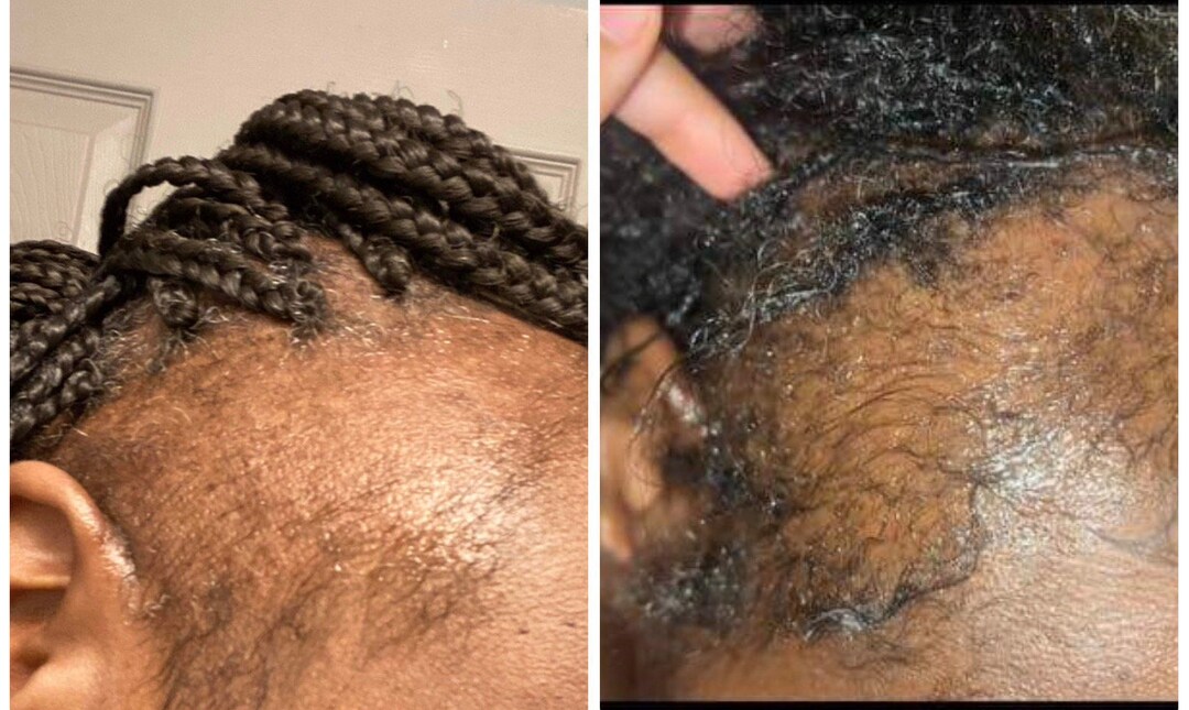 Thick and Full Edges & Hair Growth Oil Wholesale / Extra Strength Hair ...