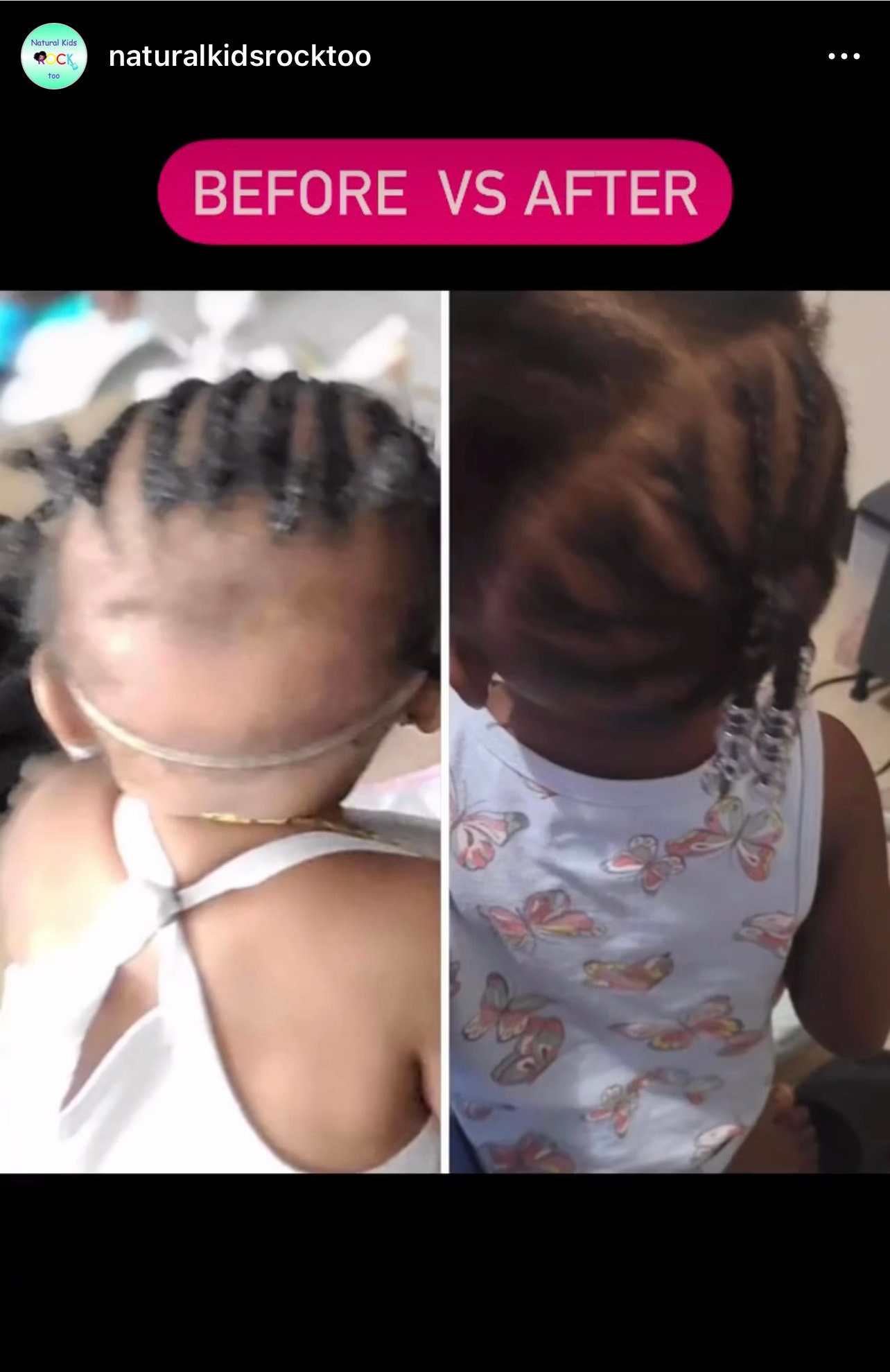 Thick and Full Edges & Hair Growth Oil Wholesale / Extra Strength Hair ...