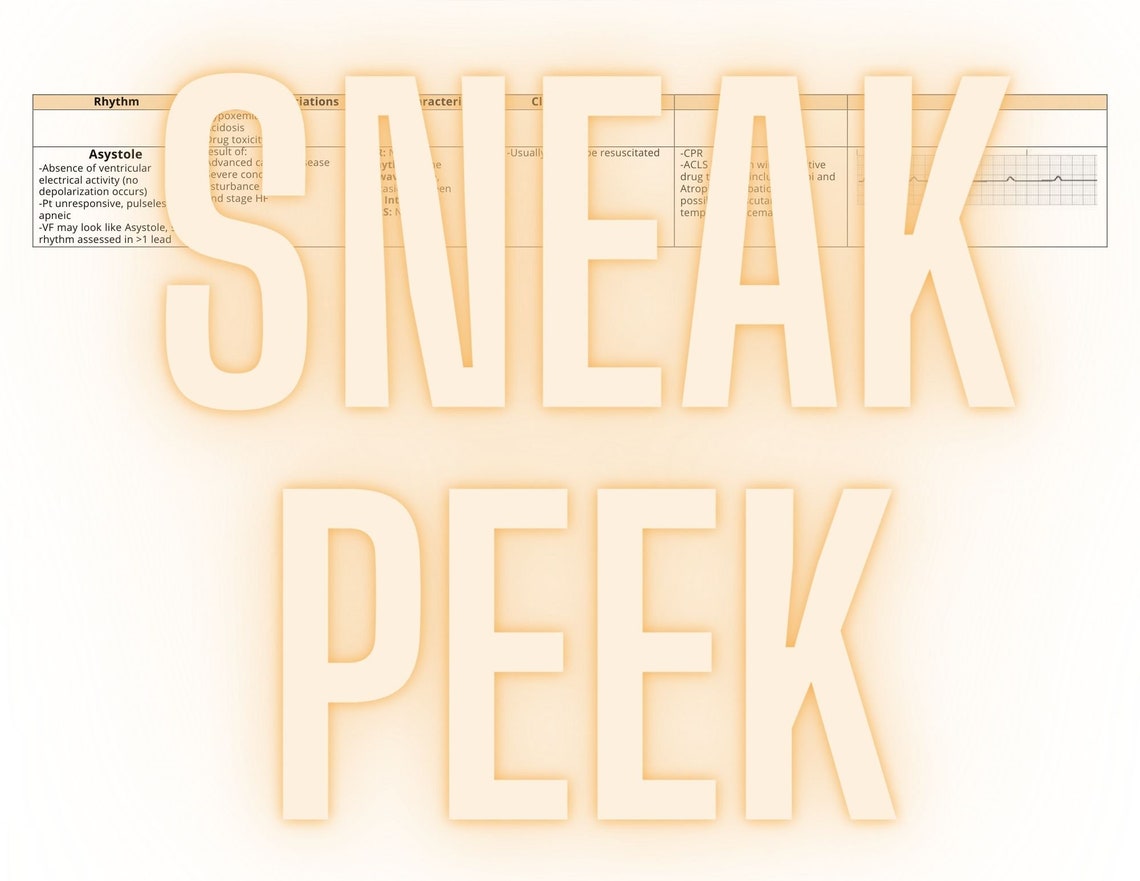 EKG Basics Printable Chart PDF - Etsy